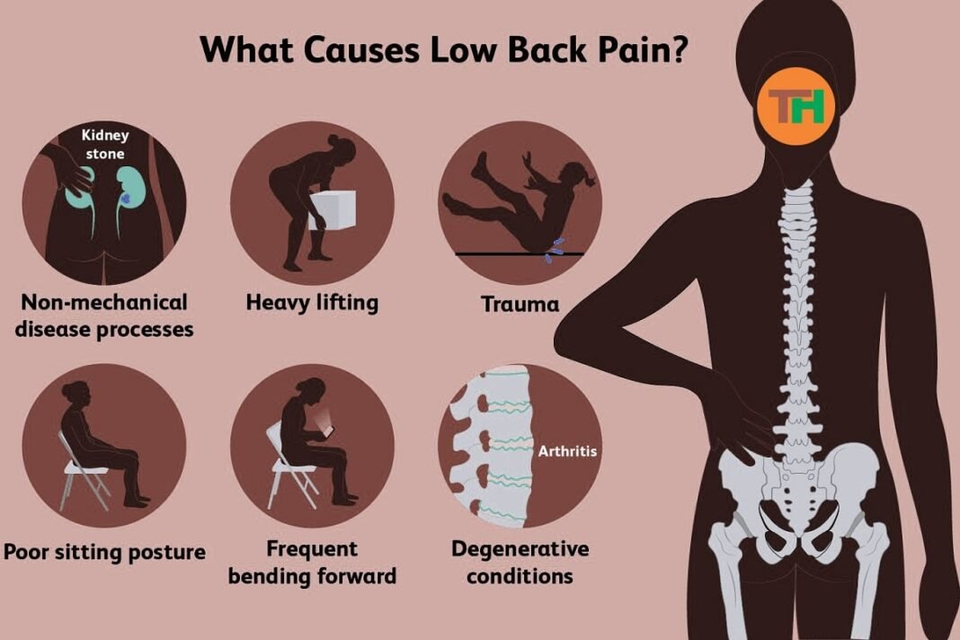 What is Back Pain? Symptoms, Causes, and Treatment - Trend Health